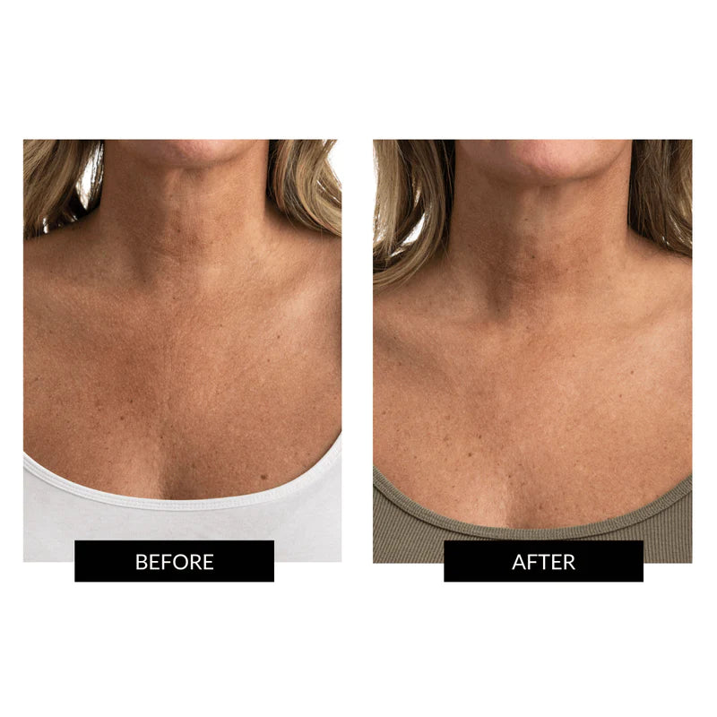 Skin LED Neck and Dec Perfector | The Skin Savant by Amy Peterson