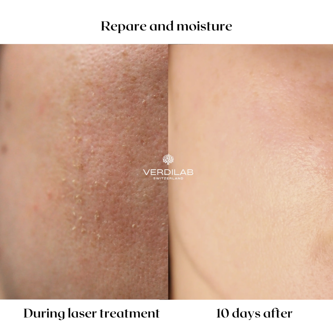 Natural Detox Replenishing Face Mask | The Skin Savant by Amy Peterson